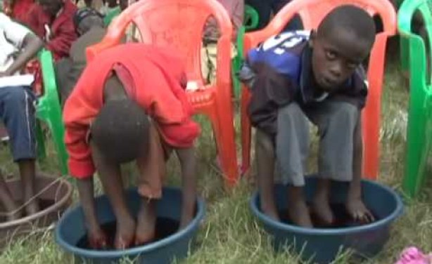 Kenya: Hundreds of Lamu Kids With Jiggers - allAfrica.com